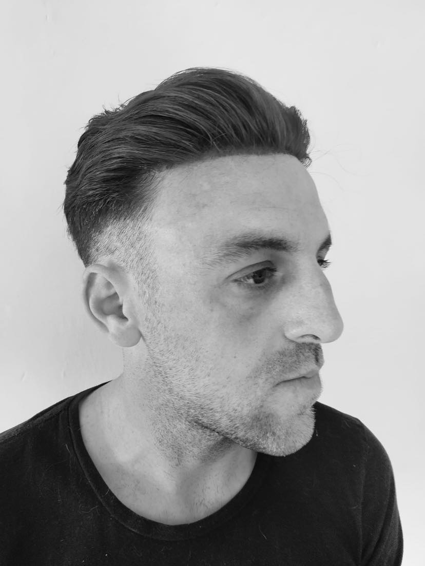 Hair Replacement Systems Essex | Wonderful Hair Systems